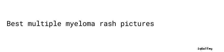 Progentra Male Enhancement Pills Reviews - Aula Ambiental