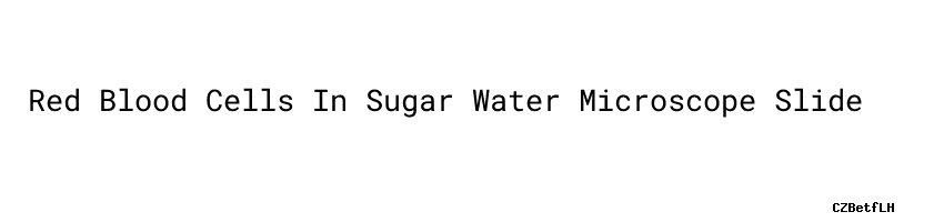 Red Blood Cells In Sugar Water Microscope Slide - Thyroid Blood Sugar ...