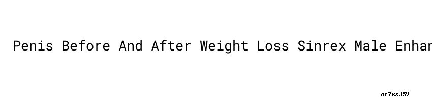 Penis Before And After Weight Loss Sinrex Male Enhancement Pills ...